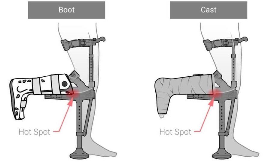 iWALK 3.0 Hands Free Crutch for Leg - WalkingSticks.co.uk